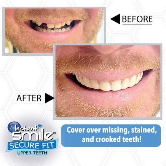 Instant Smile Secure Fit Upper Teeth - Instant Smile
