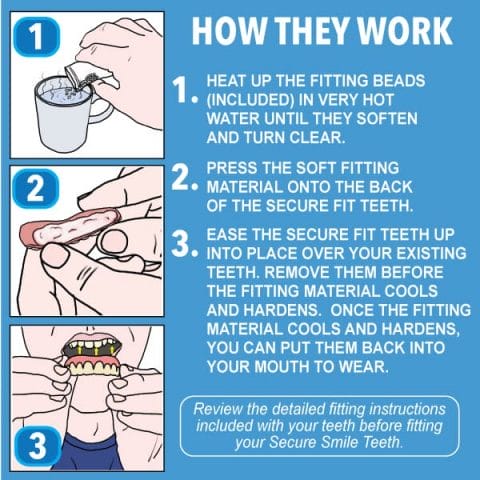 Instant Smile Secure Fit Upper Teeth - Instant Smile